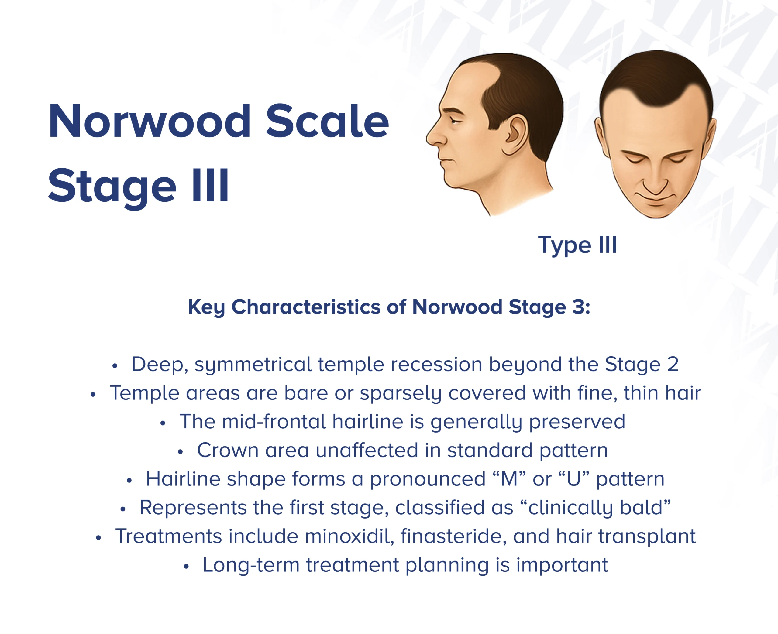 Escala de Norwood: Etapas de la Pérdida de Cabello y Tratamientos ...