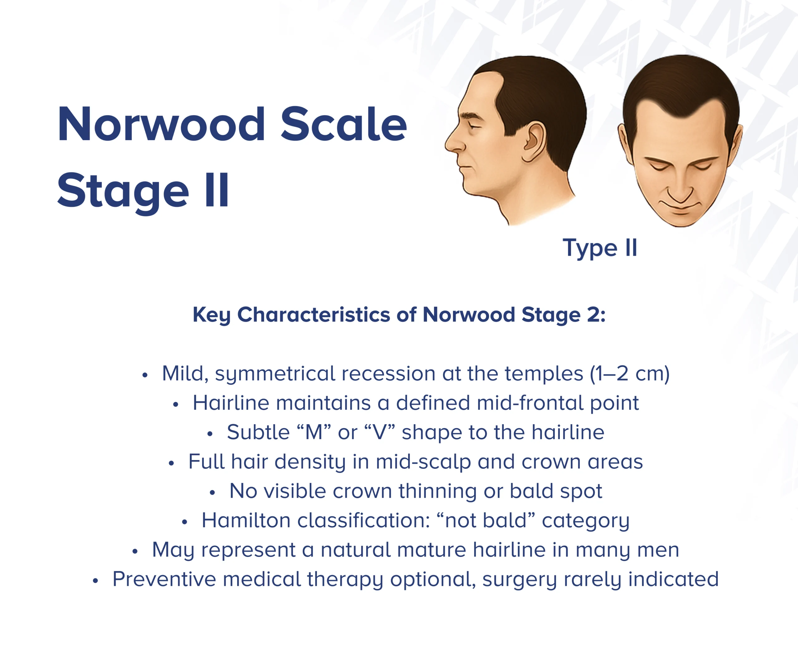 Escala de Norwood: Etapas de la Pérdida de Cabello y Tratamientos ...