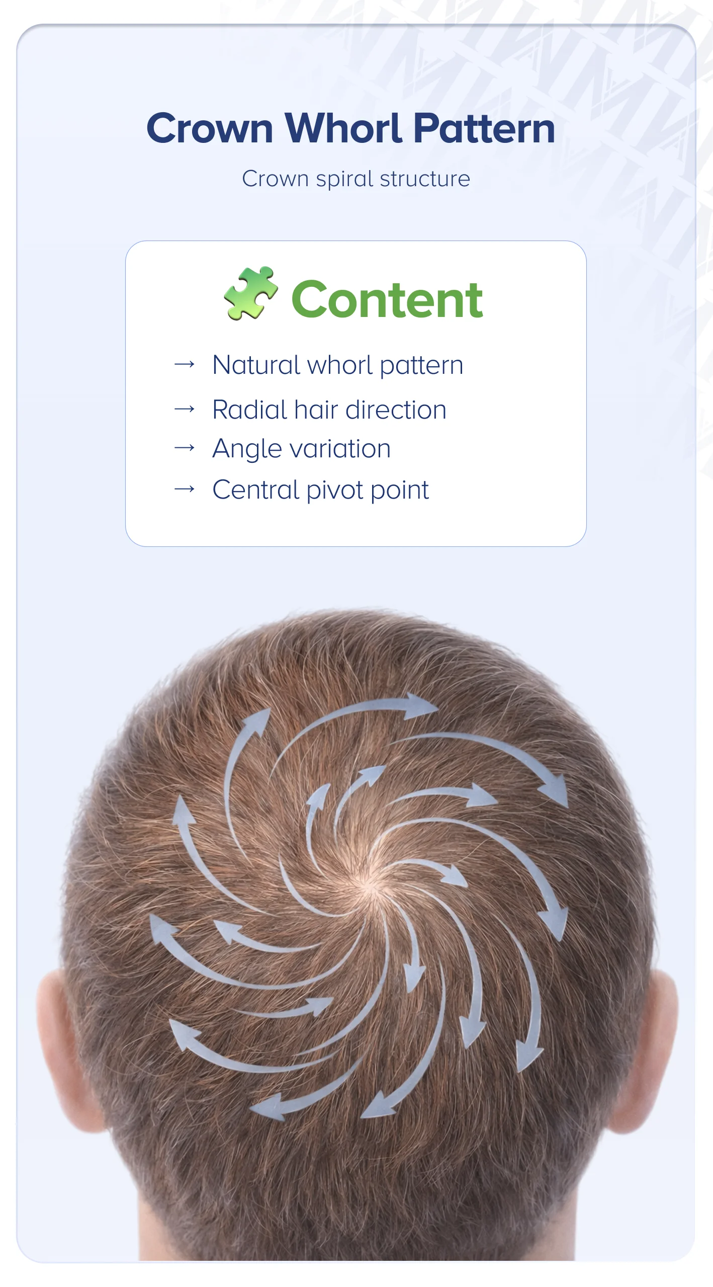 Hair Transplant Crown & Vertex: Challenges, Grafts Needed, and ...