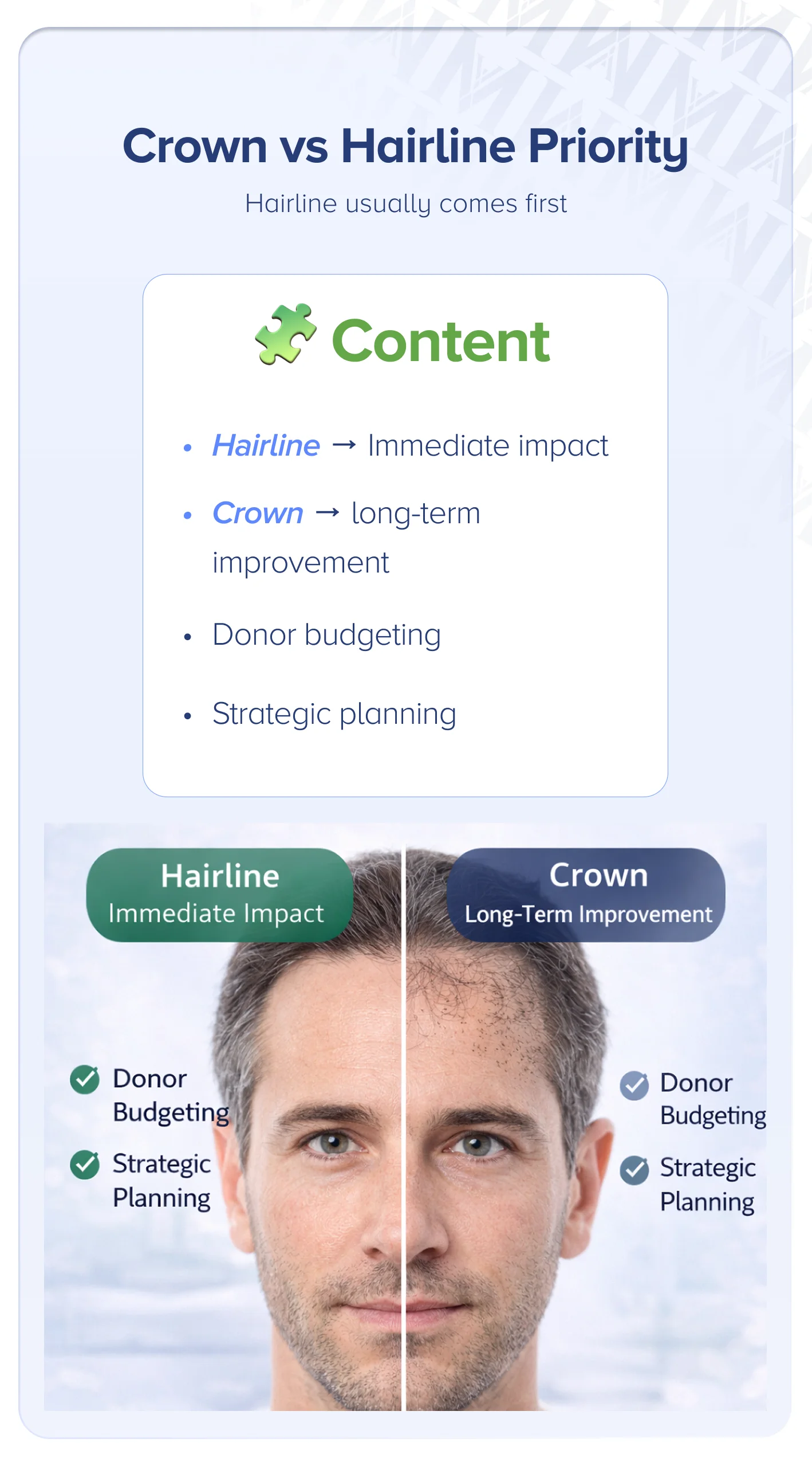 Hair Transplant Crown & Vertex: Challenges, Grafts Needed, and ...